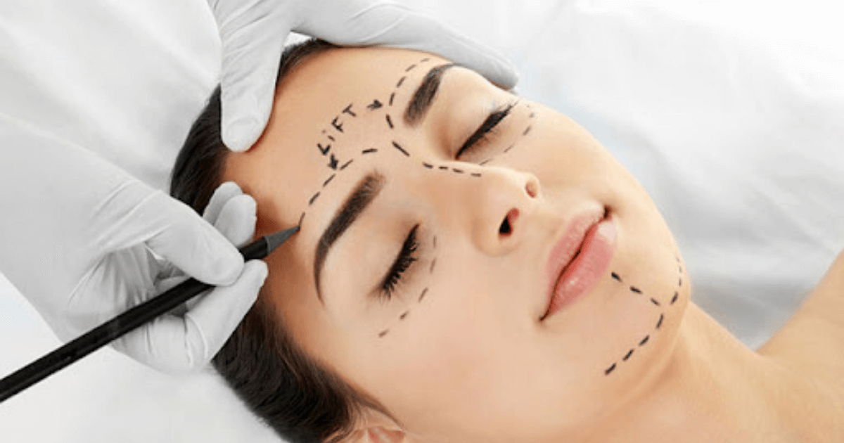 Lifting obraza za mladosten in svež videz brez gubic