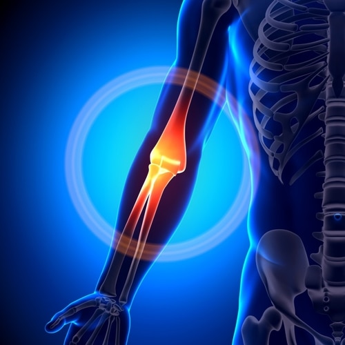 Elbow - Stretching, Exercises, & Posture | Work-Fit