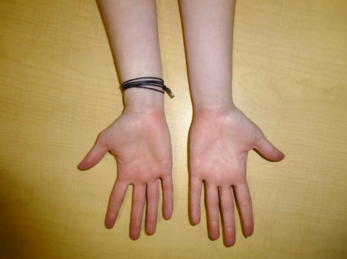 Wrist & Hand - Stretching, Exercises, & Posture | Work-Fit