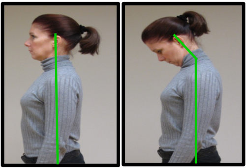 Neck & Upper Back - Stretching, Exercises | Work-Fit