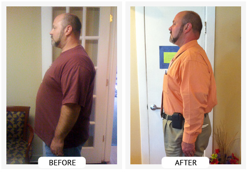 ChiroThin | Weight Loss | Bradley Chiropractic Clinic