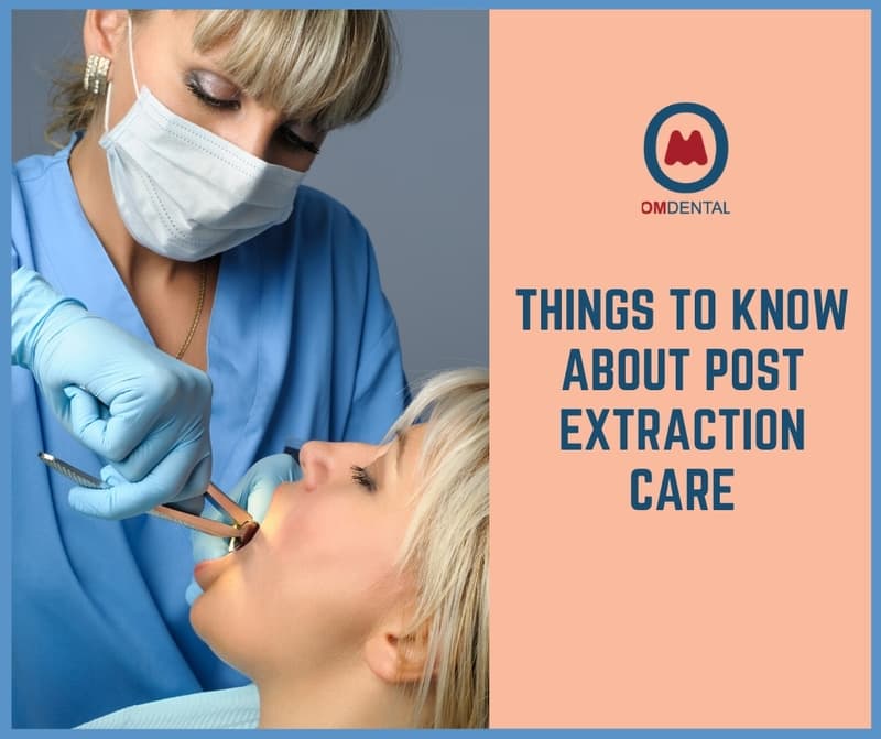 Things to know about post extraction care