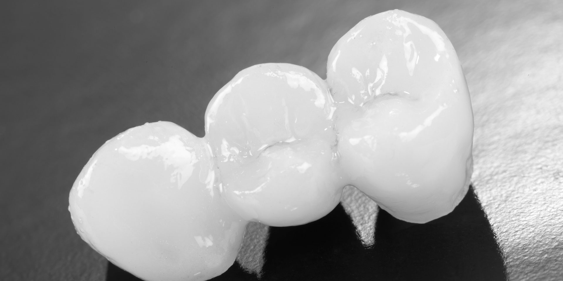 Porcelain Fixed Bridges | Dayton Dental Collaborative