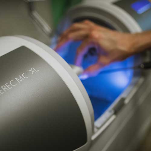 A Few Things that You Should Know About Our CEREC Technology ...