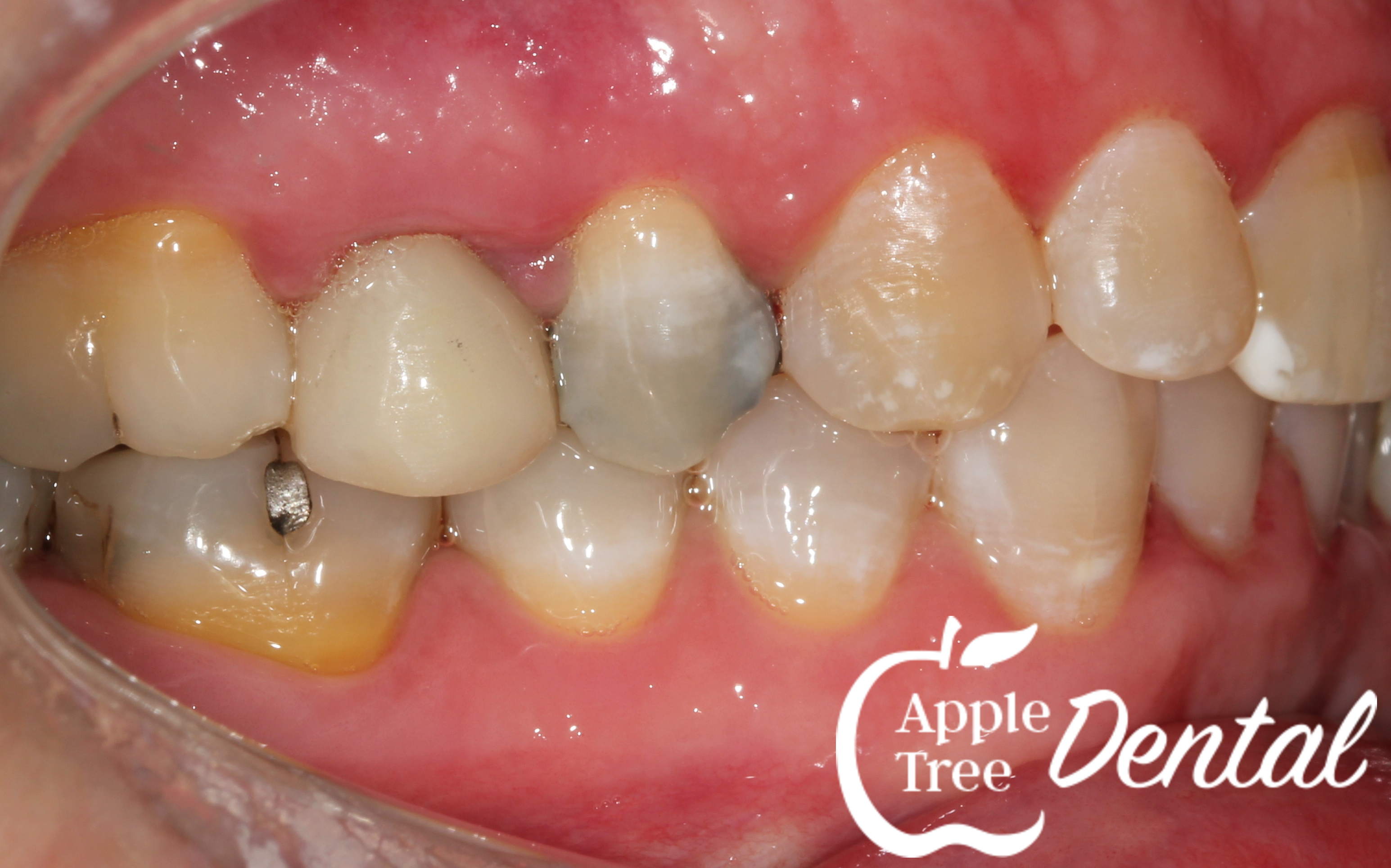 What is the blue light all about? - Blog