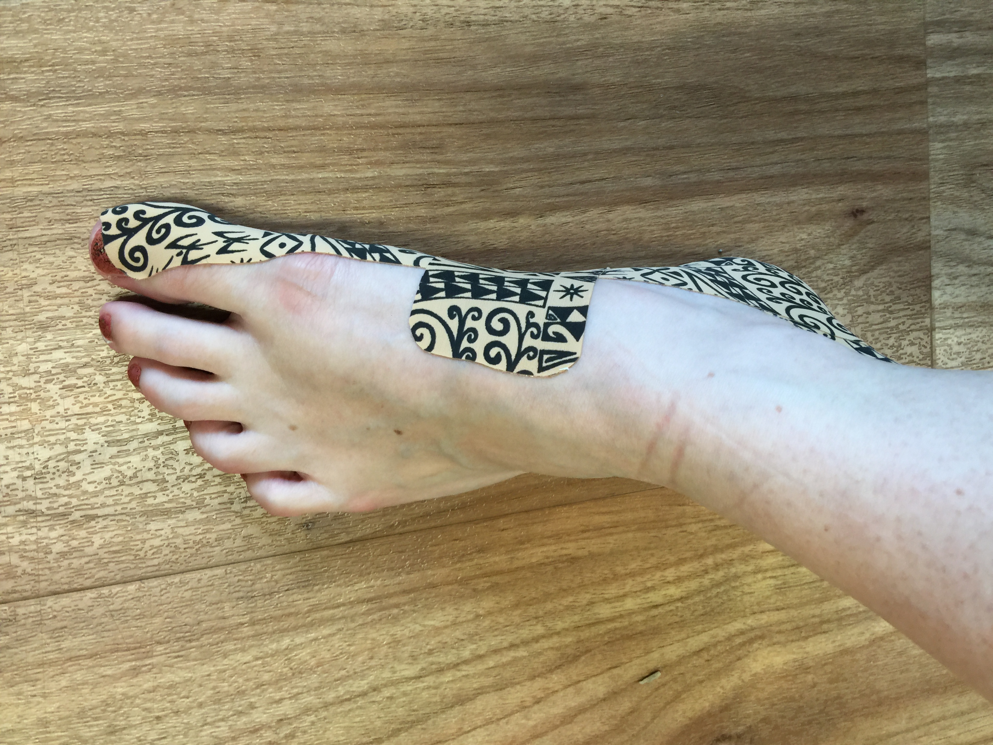 Dynamic Tape - das biomechanische Tape im Tattoo-Style aus Australien