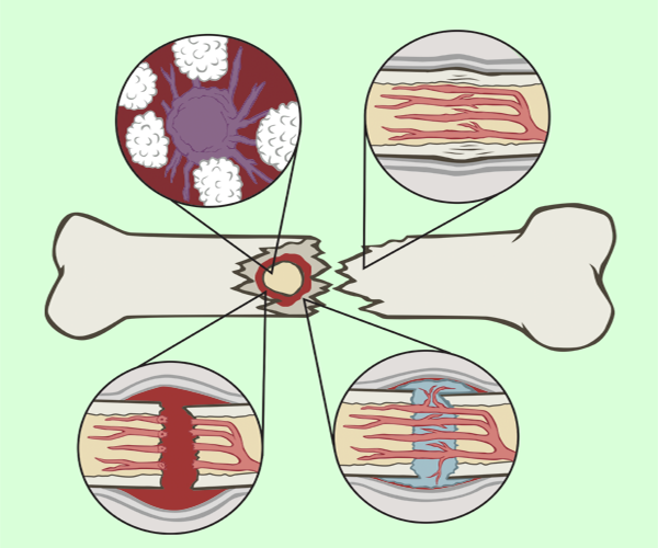 bone-student-reading-pages-the-partnership-in-education