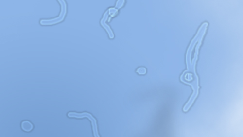 What is Flashes and Floaters - Eyedeal Vision explains Flashes and ...