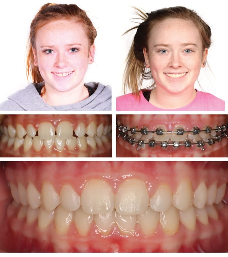 Orthodontics and Pediatric Dentistry - Kansas City