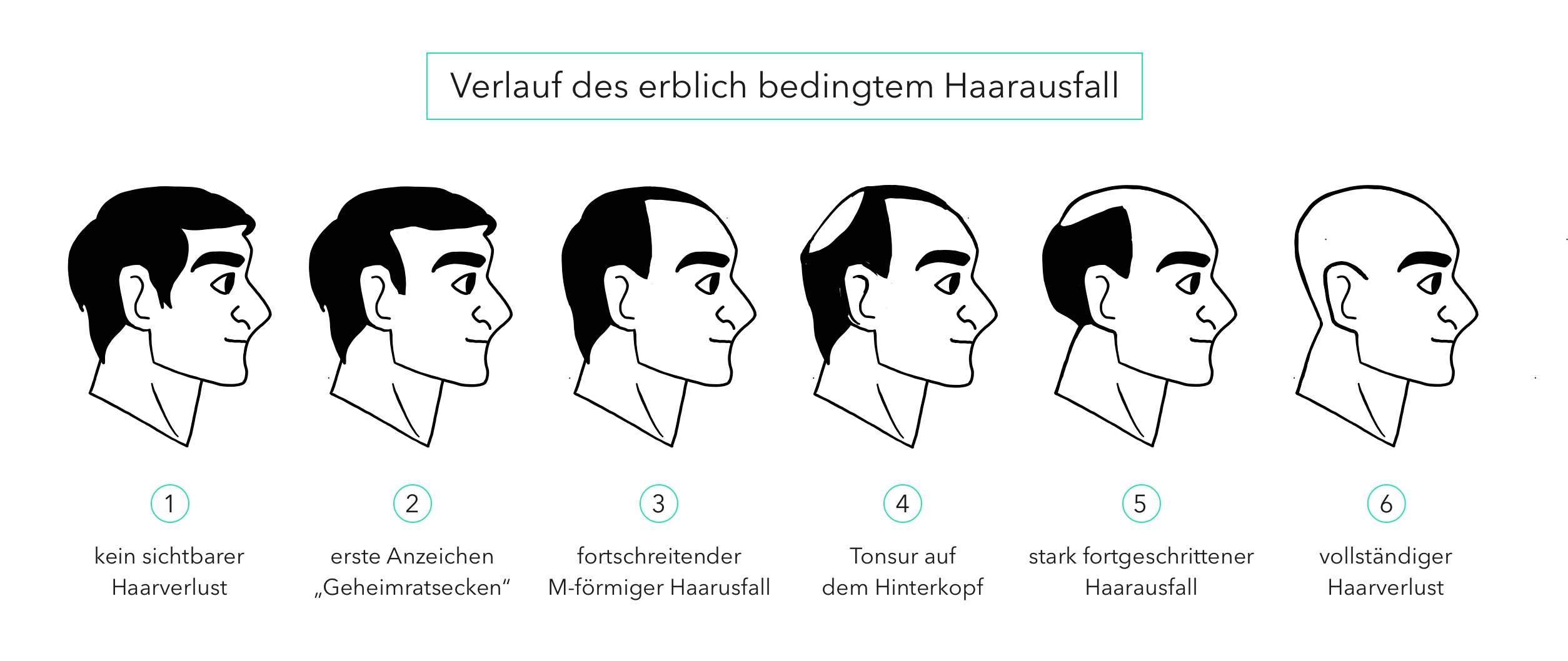 Die ersten Anzeichen von Haarausfall erkennen! | Spring