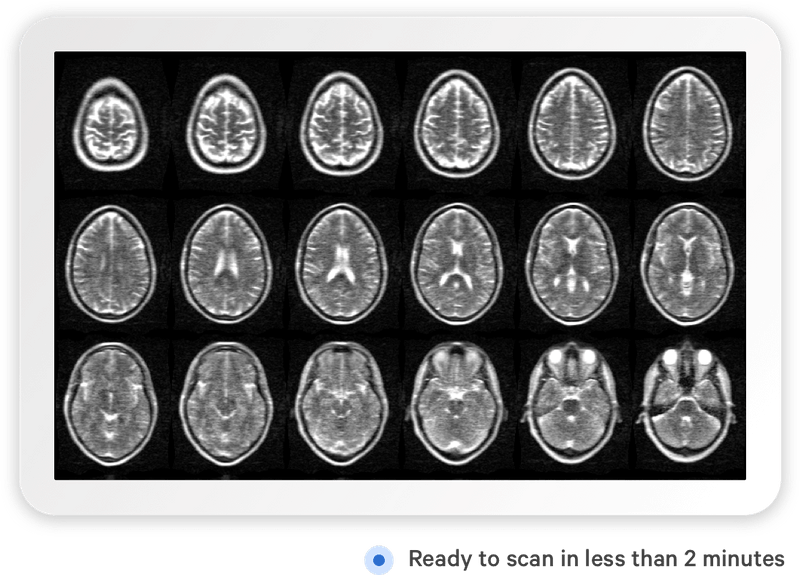 Portable MRI : r/Radiology