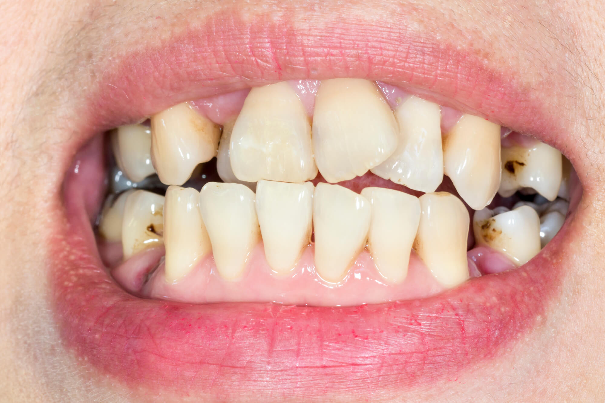 What Orthodontic Problem Do You Have?
