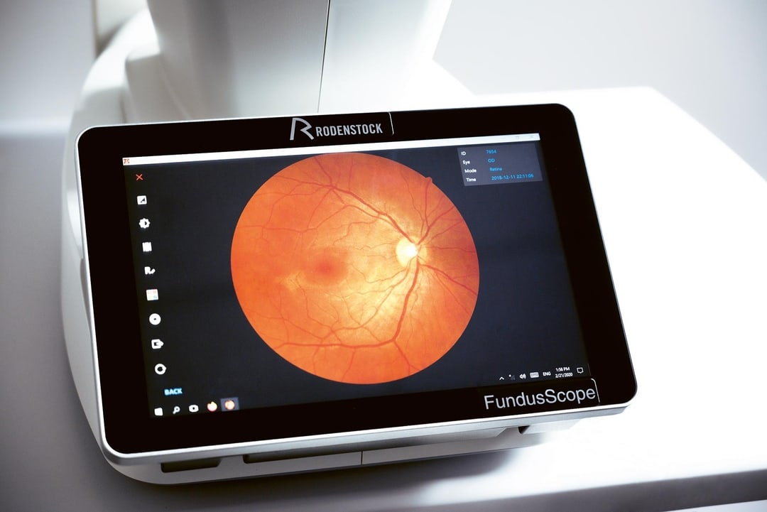 Diagnostic – Fundus Camera: FundusScope