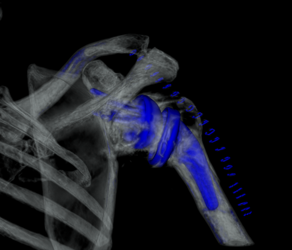 Cairns Hospital December 2017 - Shoulder Clinic