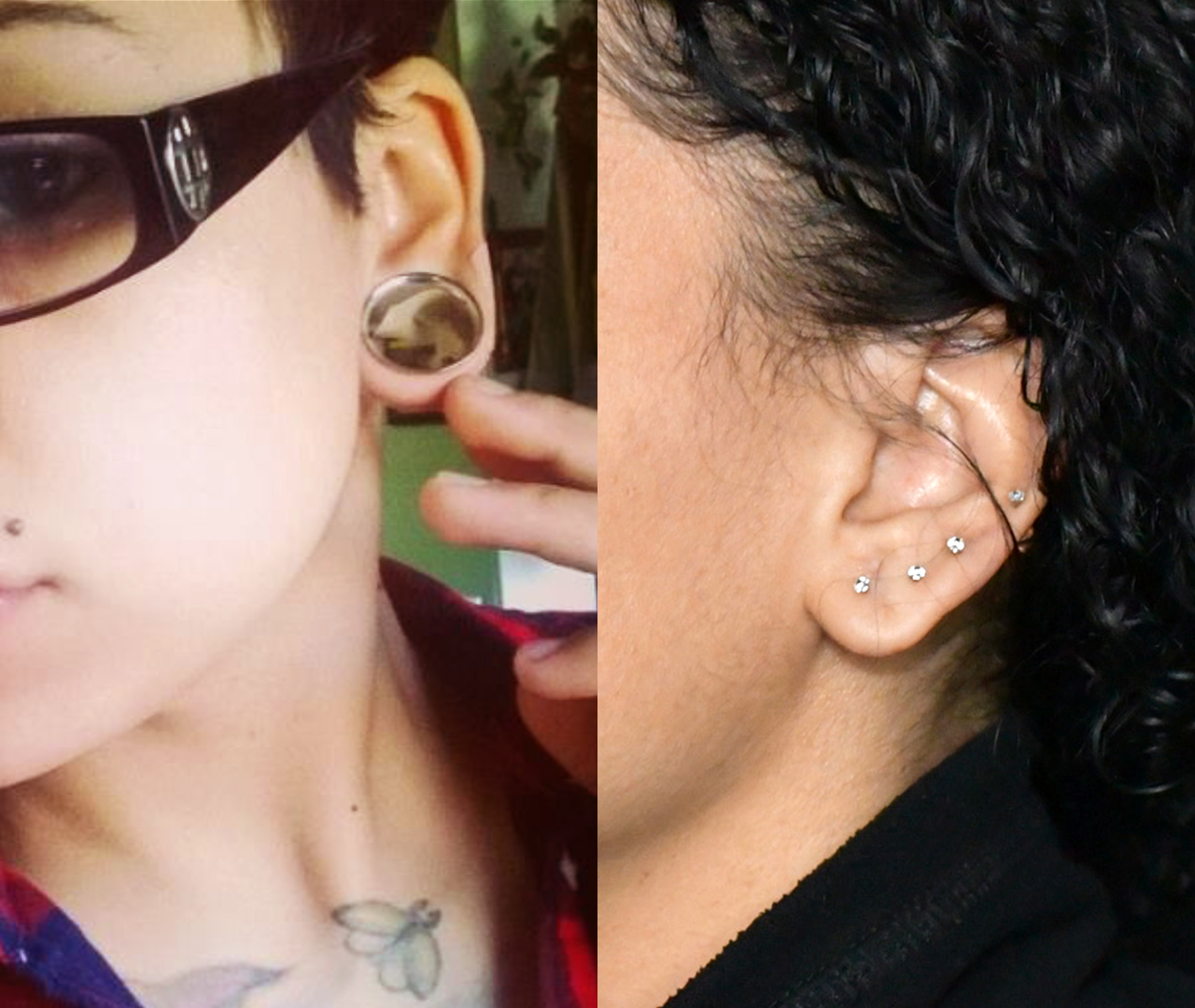 Before & After Photos Earlobe Repair 3 | NYC