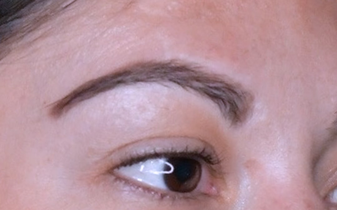 Before & After Photos Mohs Surgery Ear 3 | NYC