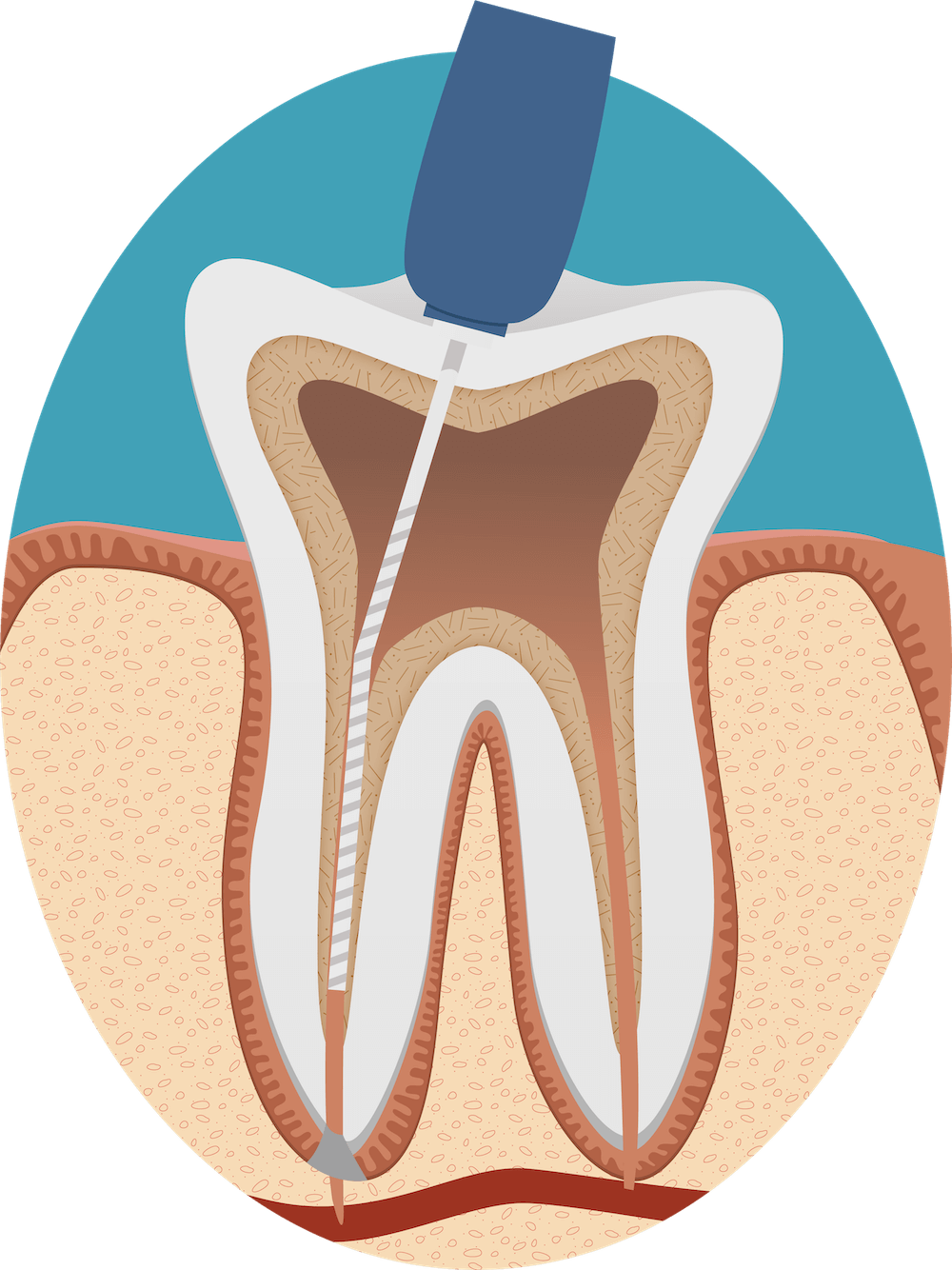 About Mickel Microsurgical Endodontics in Ohio