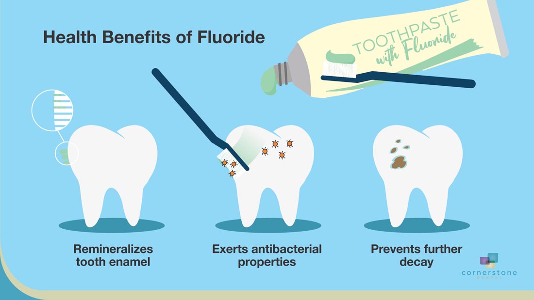 Fluoride Varnish Cornerstone Dental Fluoride Varnish Cornerstone Dental