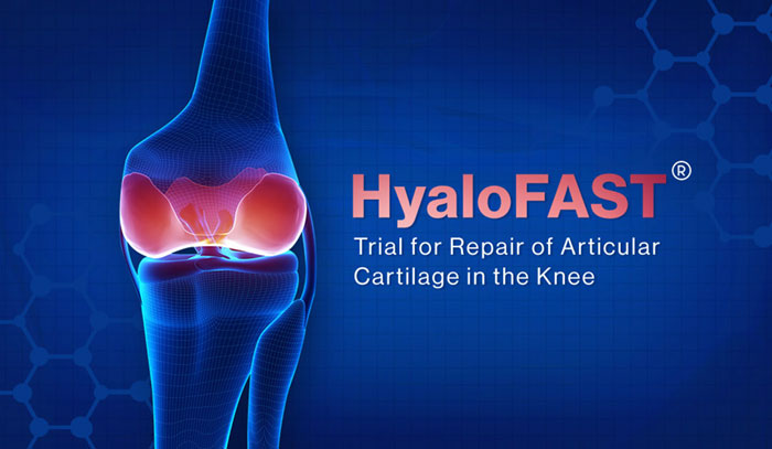 Painful Knee Joints can be a Thing of the Past