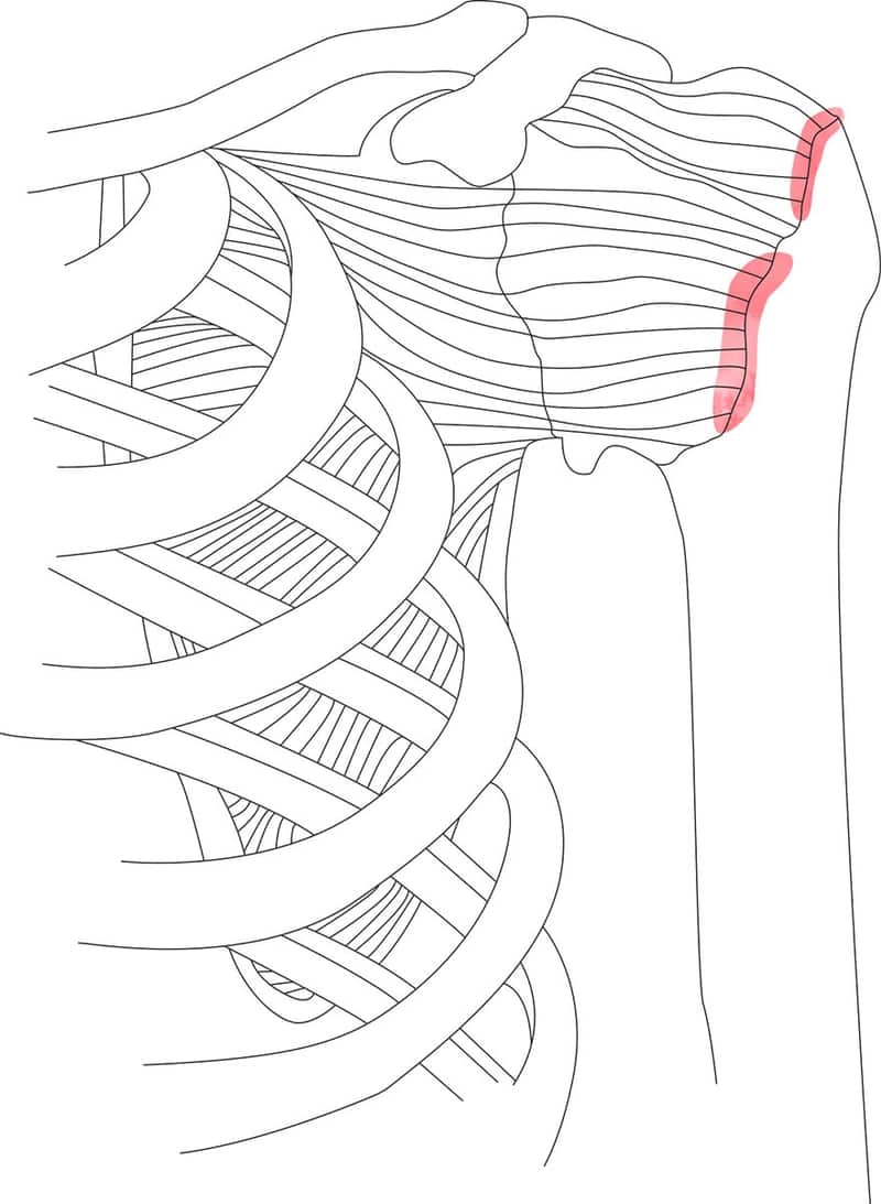 Rotator Cuff Tear - Shoulder Clinic