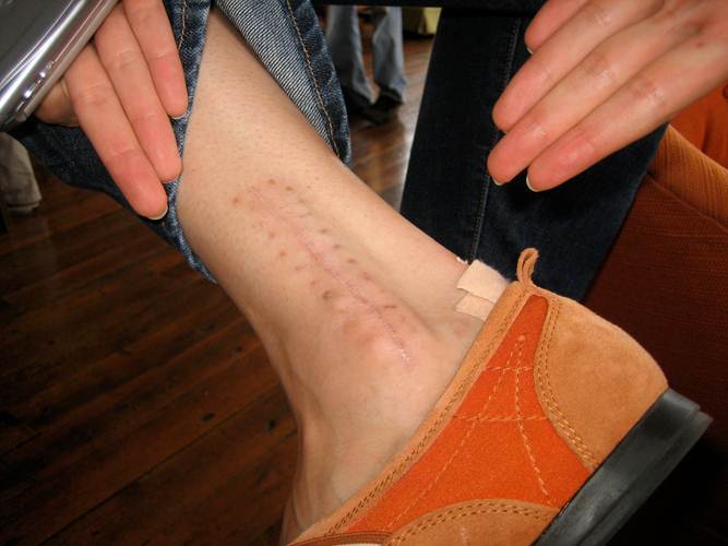 Cycling Injuries And Our Legal System cycling-injuries-and-our-legal-system