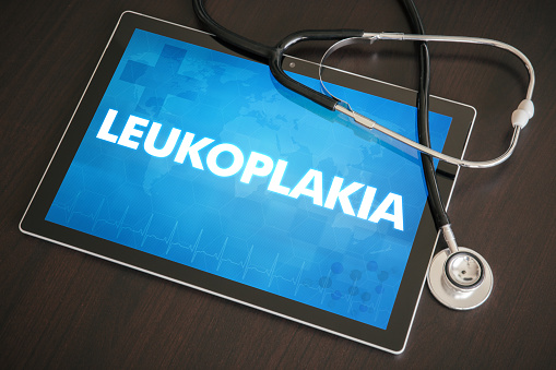 Q: What Is Leukoplakia? | Dental Image Therapy Centres