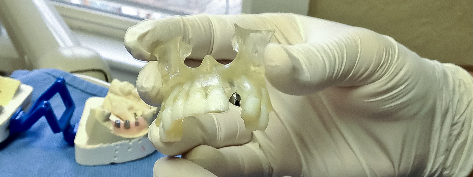 Implant Therapy Services