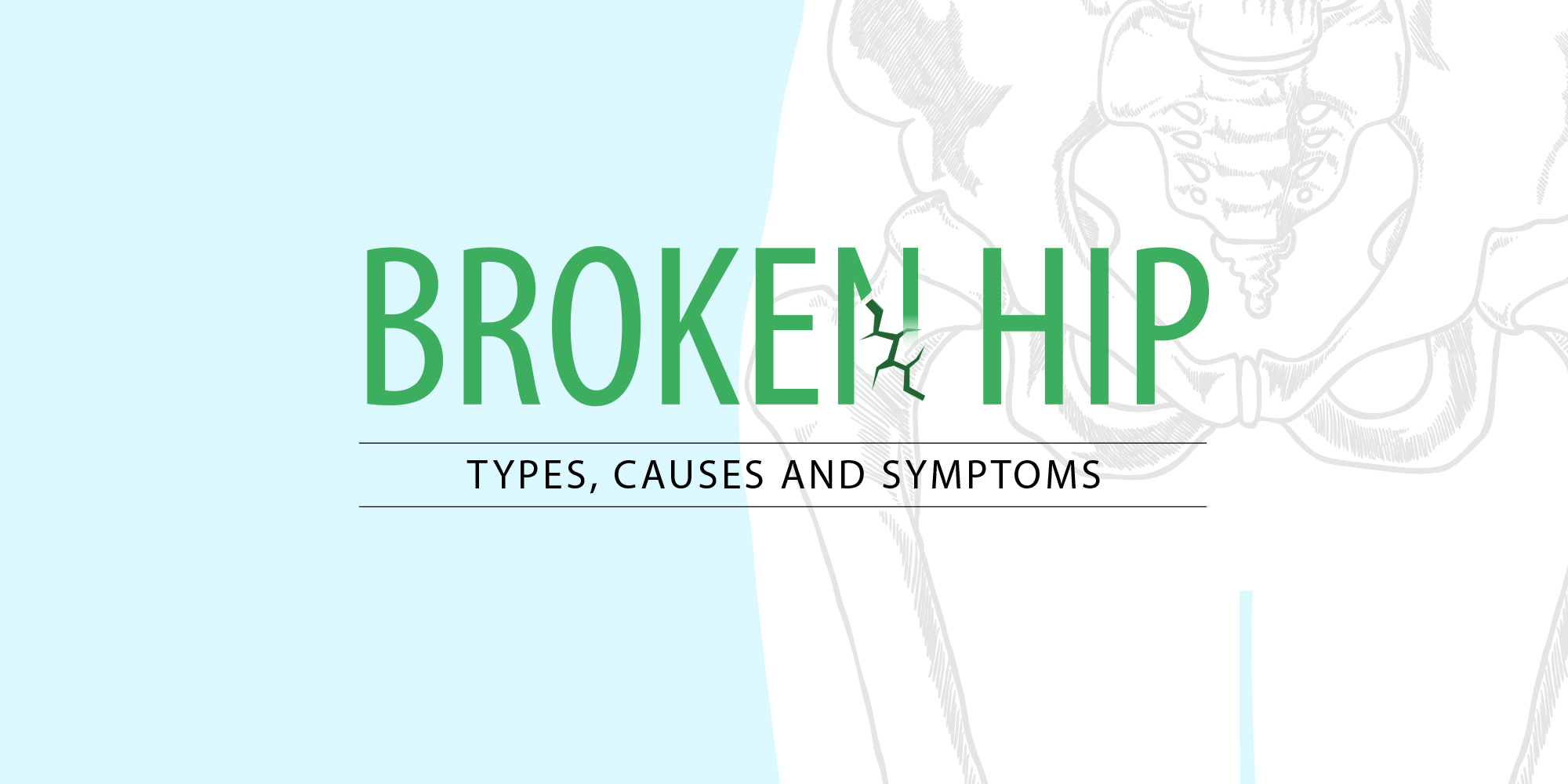 Broken Hip: Types, Causes and Symptoms | CareLinx