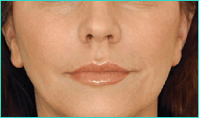 Beauty Essentials - Facial Treatments