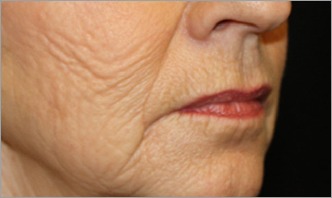 Beauty Essentials - Facial Treatments