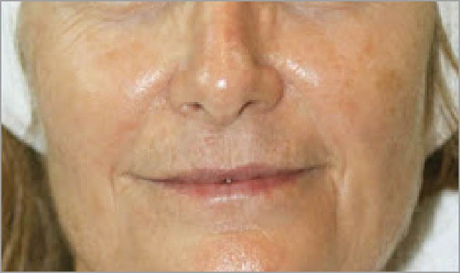 Beauty Essentials - Facial Treatments