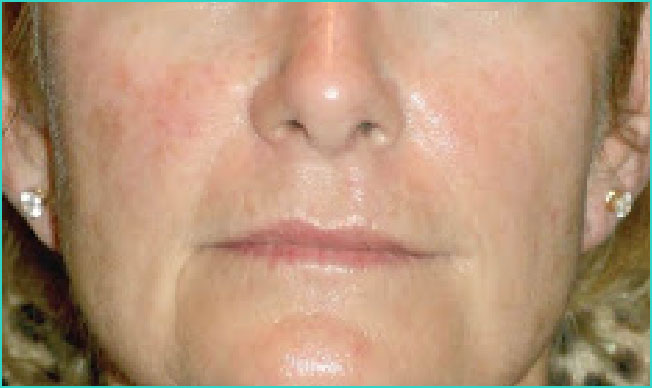 Beauty Essentials - Facial Treatments