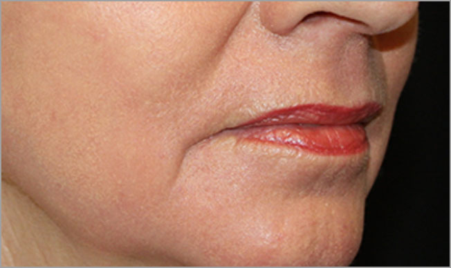 Beauty Essentials - Facial Treatments