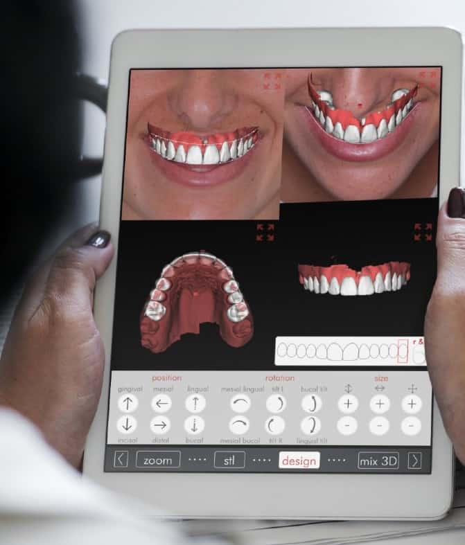 Digital Smile Design for Smile Makeovers
