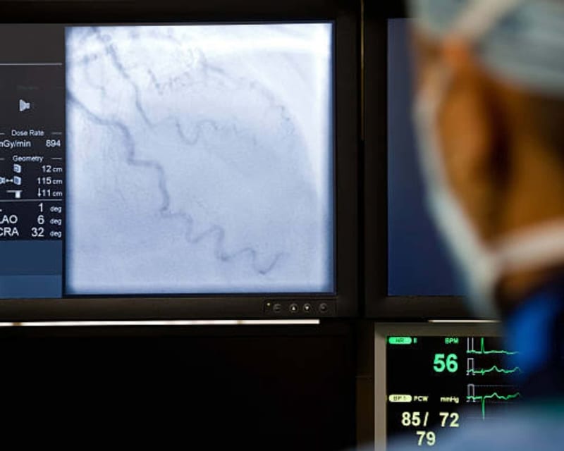 Blood Vessel Conditions: How an Angiogram Can Help Your Diagnosis ...