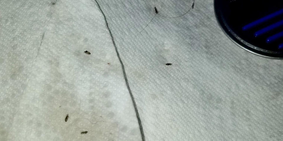 The Reproduction of Head Lice | LiceDoctors