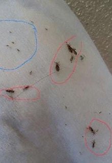 The Reproduction of Head Lice | LiceDoctors