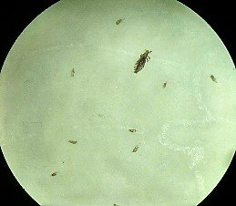 How do you know if you are looking at a nit (louse egg)?