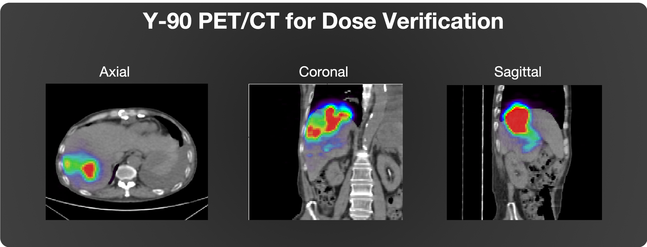 Roncali Lab - Research