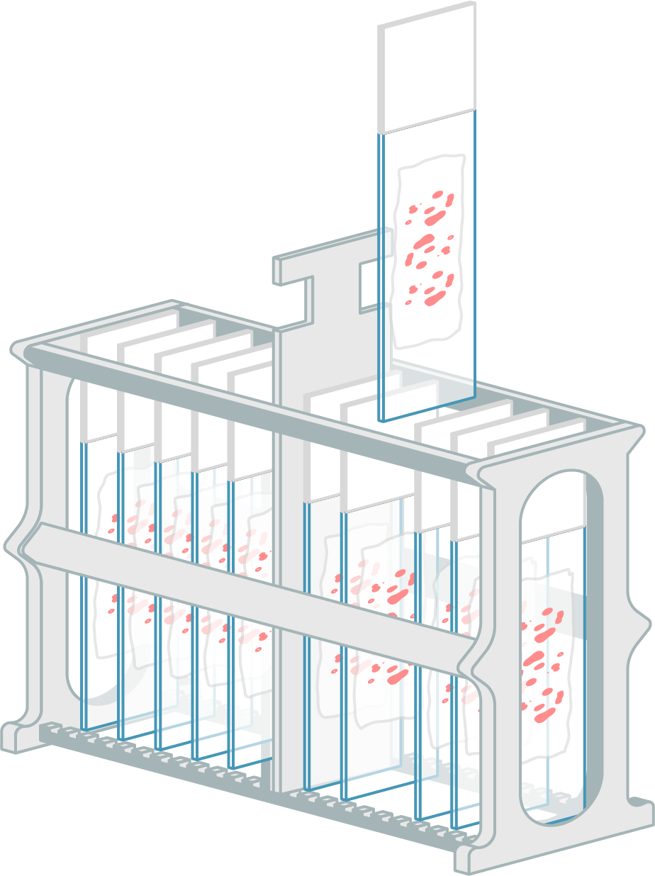 IHQ segunda etapa: recuperación de antígenos