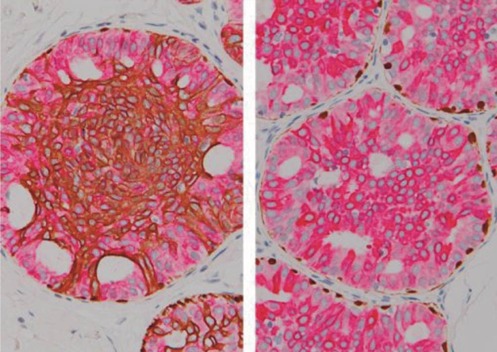 Inmunotinción Multiplex: simultánea vs. Secuencial