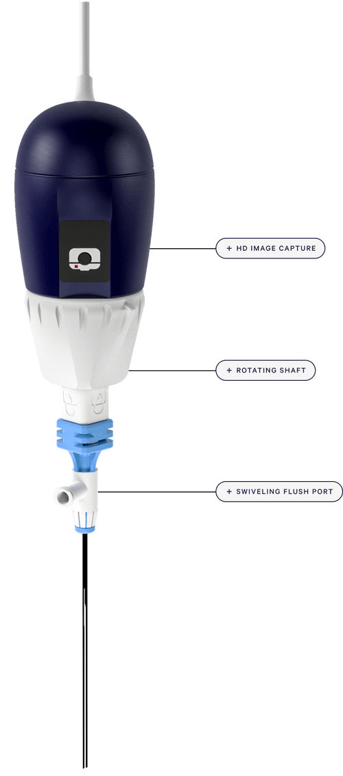 30 SideVu from IntraVu