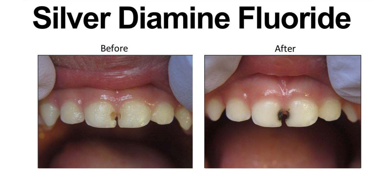Top Rated Mobile Dental Clinic In Washington SoundDentalCare Top Rated Mobile Dental Clinic In Washington SoundDentalCare