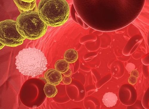 Sepsis | DNAe
