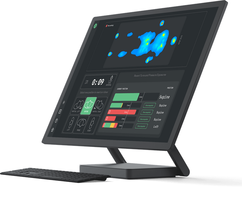 XSENSOR | Patient Bed Monitoring