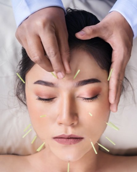 Acupuncture Hub - Lower Back Pain