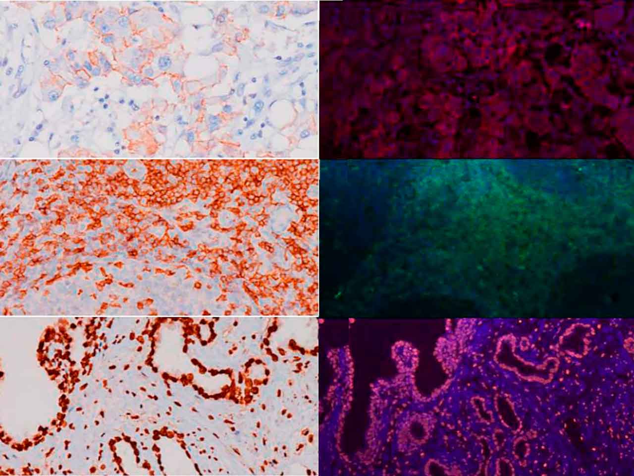 Ventajas de usar inmunofluorescencia para analizar anticuerpos ...