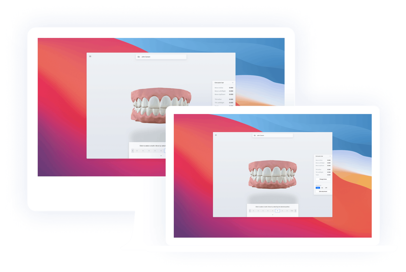 ArchForm - Simple, powerful 3D software to setup aligner cases