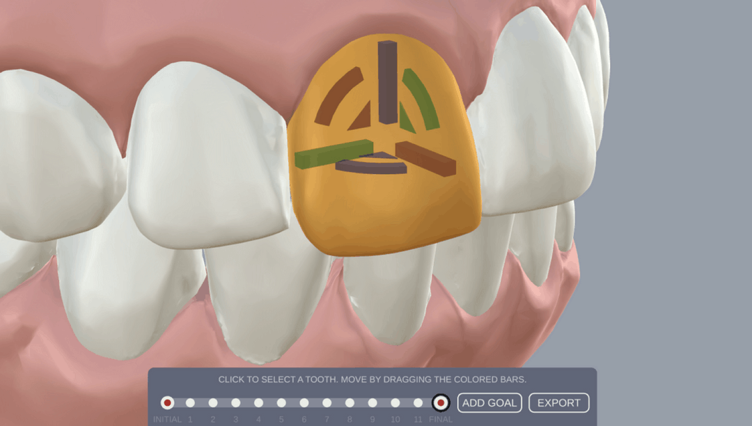 ArchForm - Simple, powerful 3D software to setup aligner cases