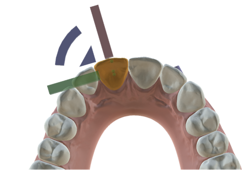 ArchForm - Simple, powerful 3D software to setup aligner cases